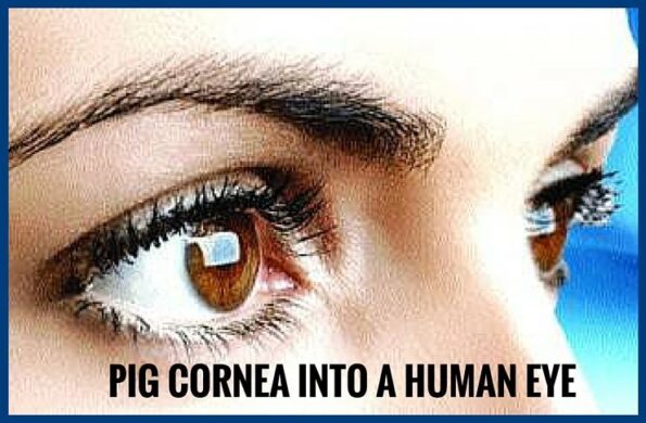 Pig eye surface into a human eye - PGurus