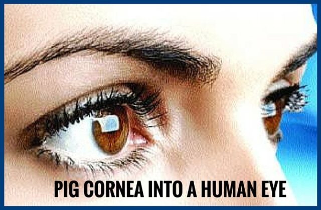 Pig eye surface into a human eye - PGurus