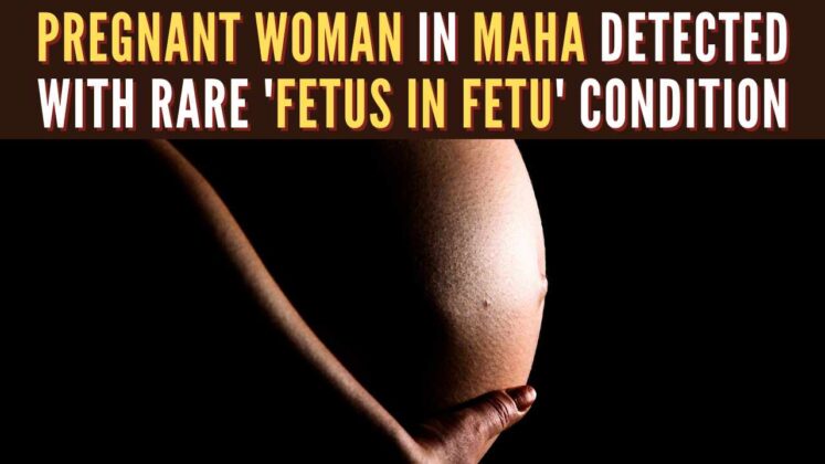 Rare ‘Fetus in Fetu’ Case Detected in Pregnant Woman